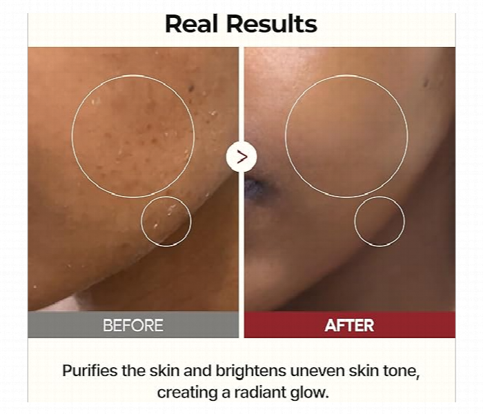 Buy Dr. Melaxin Peel Shot Glow Wh7158270 Price in Qatar, Doha